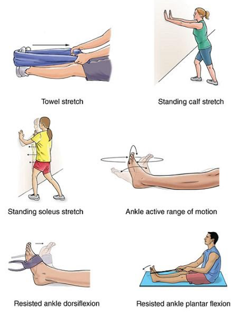 Ankle MBO(Modified Brostrom Operation) - 발목 인대 봉합술 : 네이버 블로그
