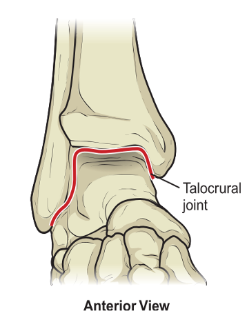 Ankle MBO(Modified Brostrom Operation) - 발목 인대 봉합술 : 네이버 블로그