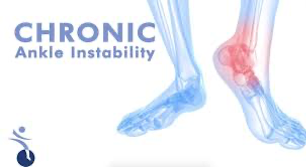 Ankle MBO(Modified Brostrom Operation) - 발목 인대 봉합술 : 네이버 블로그