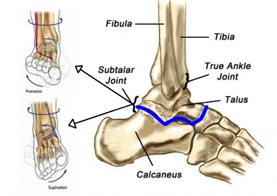 Ankle MBO(Modified Brostrom Operation) - 발목 인대 봉합술 : 네이버 블로그