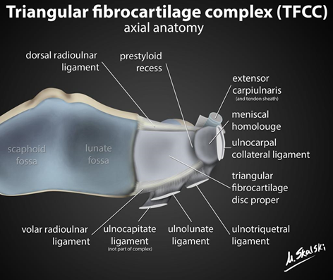 Wrist TFCC(Triangular fibrocartilage complex) injury - 손목 삼각섬유연골복합체 손상 ...