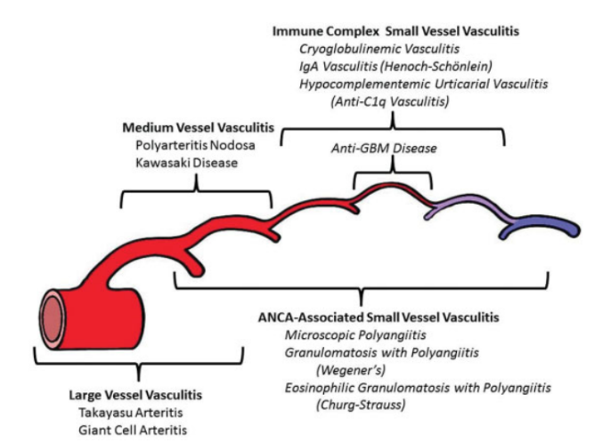 [Rheumatology] ANCA-Associated small vessel vasculitis에는 MPA, GPA, EGPA ...