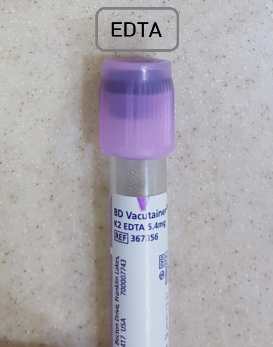 신규간호사공부 간호사 혈액검사 채혈보틀종류 Lab Bottle 네이버 블로그
