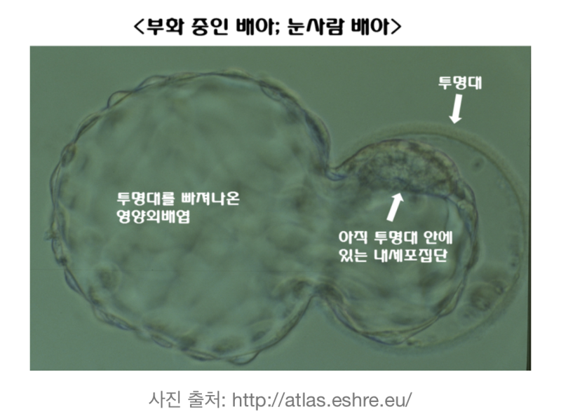 난임일기 강남차병원 시험관 냉동 2차 6일배양 눈사람배아 이식 후 증상1~5일차 네이버 블로그