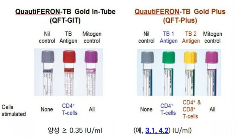 잠복결핵검사 방법 Igra 검사가능 시간 네이버 블로그