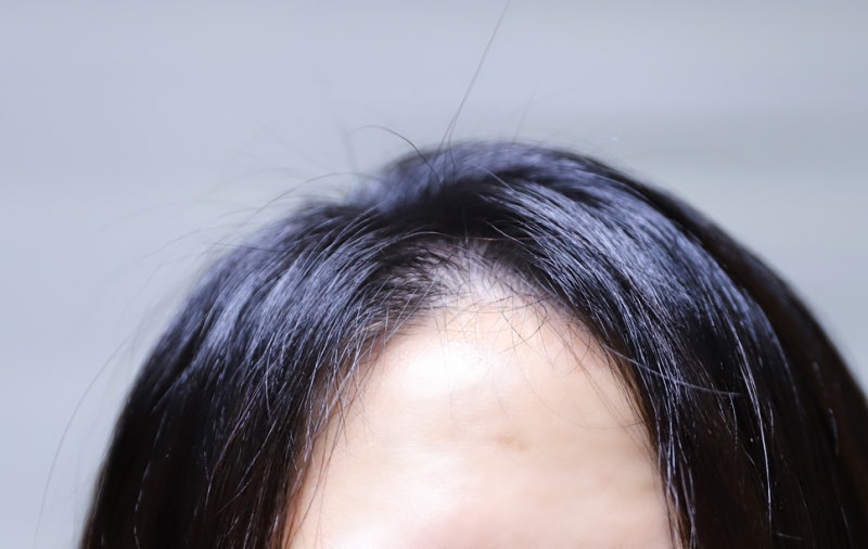 케라스타즈 제네시스 샴푸 헤어트리트먼트 풍성한 볼륨업케어 네이버 블로그