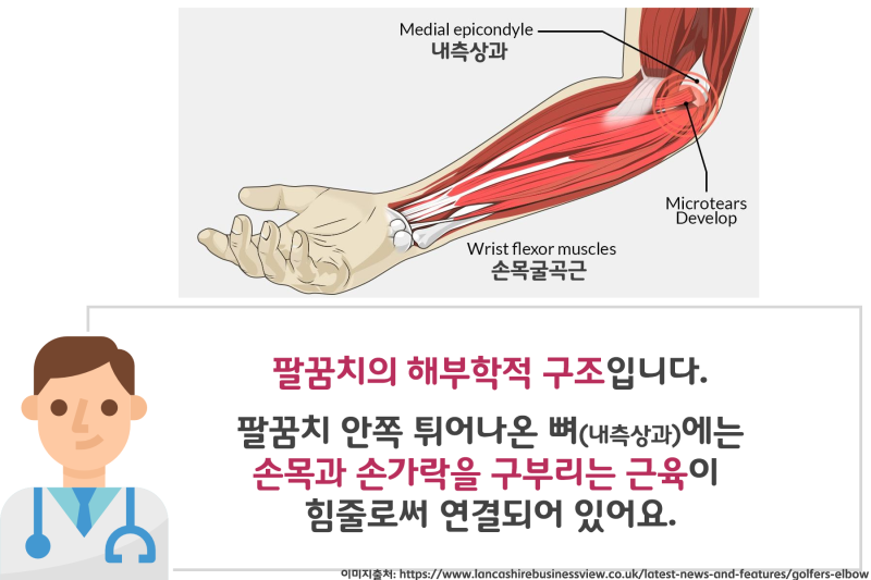동탄엘보한의원 경희푸른이 알려드리는 팔꿈치 안쪽의 통증 골프엘보우내측상과염의 원인 증상 치료 관리 네이버 블로그