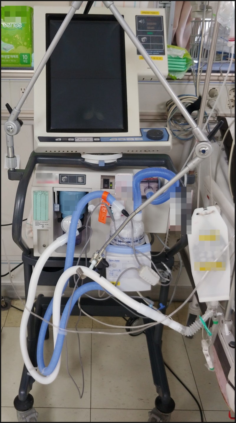 [ventilator] PB840 SST : 네이버 블로그