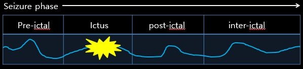 ictal(발작중 간질파)와 interictal(발작간 간질파) : 네이버 블로그