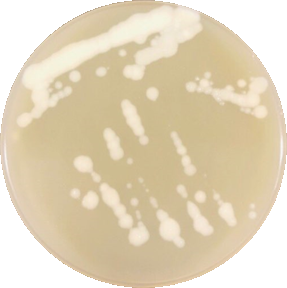 TSC Agar 원리 알고, 클로스트리디움 배양하기 : 네이버 블로그