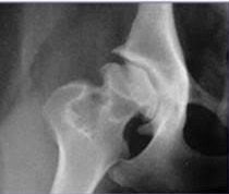 FHNO(Femoral Head & Neck Ostectomy) 대퇴골두 절단술 / 전주 코끼리 동물병원 : 네이버 블로그