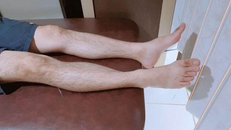 춘천 태림시술원 손흥민선수도 침맞는 곳 저도 다녀왔어요 : 네이버 블로그
