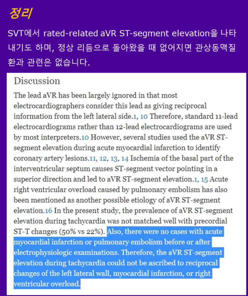 Rated-related aVR ST-segment elevation during SVT [EKG] : 네이버 블로그