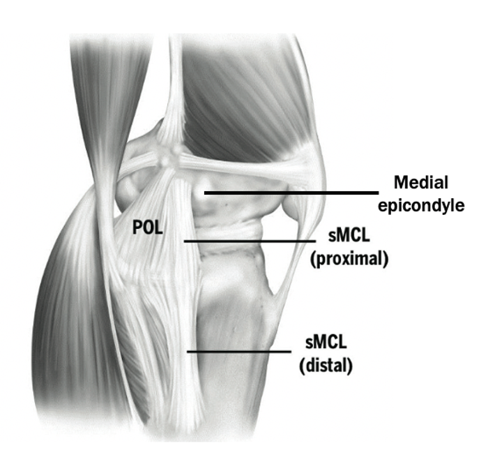 Medial collateral Ligament, MCL injury (내측측부인대 손상) : 네이버 블로그