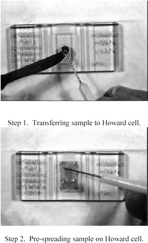 하와드 곰팡이 계수법 (Howard Mould Count Method) : 네이버 블로그