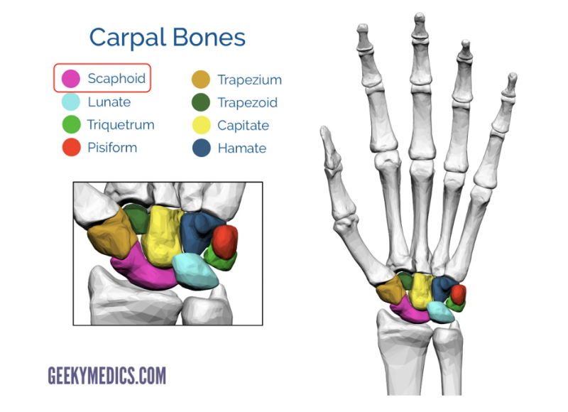 Scaphoid Fracture주상골 골절 네이버 블로그