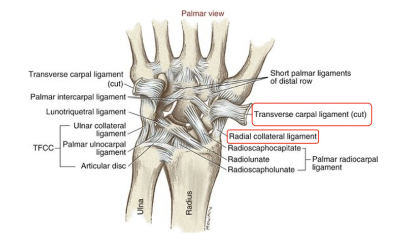 Scaphoid Fracture주상골 골절 네이버 블로그