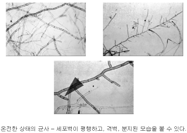 하와드 곰팡이 계수법 (Howard Mould Count Method) : 네이버 블로그