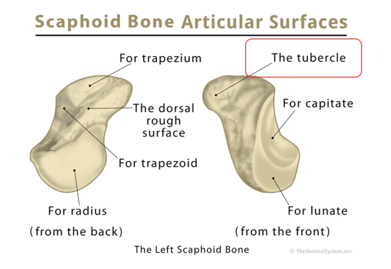 Scaphoid Fracture(주상골 골절) : 네이버 블로그