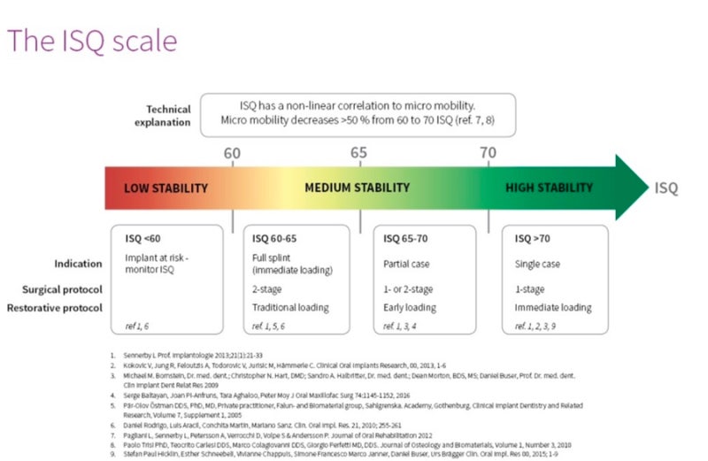 Implant 골유착(osseointegration) 정도를 알 수 있는 최신 ISQ 측정장비 Osstell Beacon ...