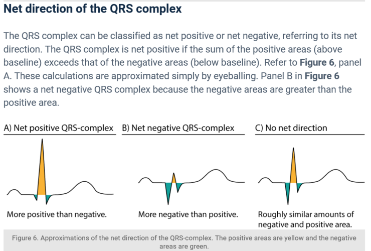 [ECG 기초] QRS complex : 네이버 블로그