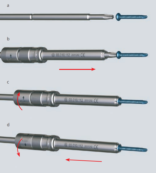 CRIF IM nail tibia - Dr.D : 네이버 블로그