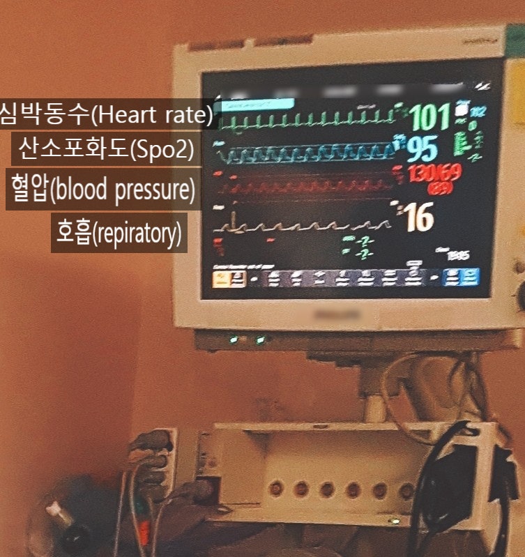 [RN] A-line (Aterial line)정리 및 간호 : 네이버 블로그