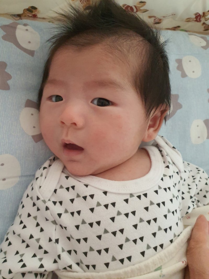 신생아지루성피부염 신생아홍반 신생아태열 극복후기 네이버 블로그