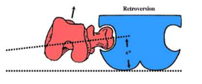 ‘전경(anteversion)/후경(retroversion)’, ‘전념(antetorsion)/후념(retrotorsion ...
