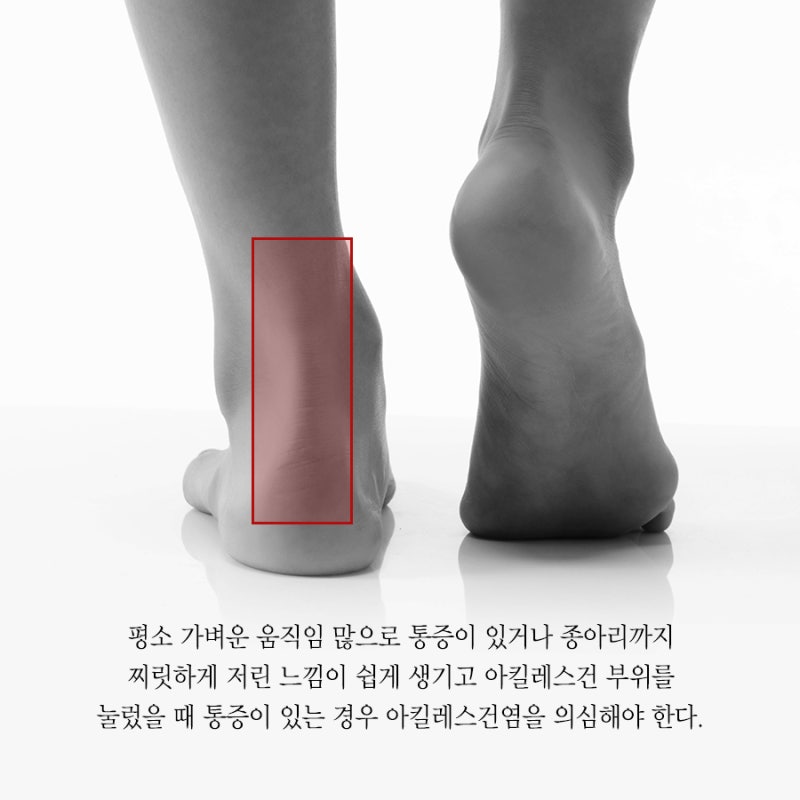 아킬레스건염 치료 재활부터 내시경수술까지 족부전문의가 말한다 네이버 블로그