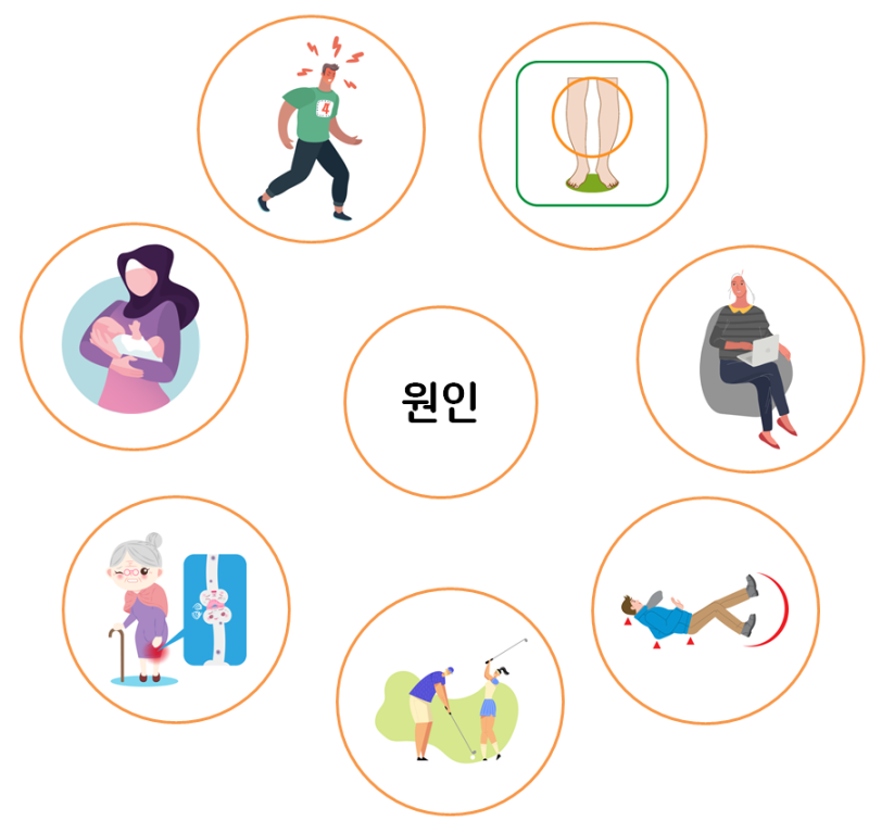 허리디스크로 오인하기 쉬운 ‘천장관절증후군이란 네이버 블로그