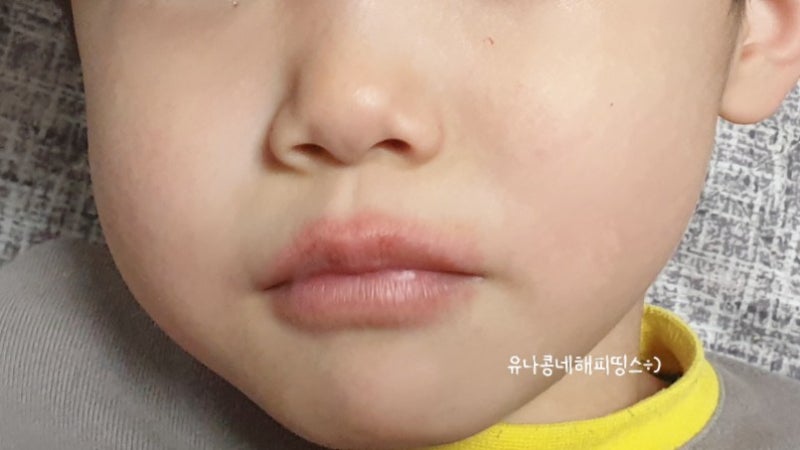 멀티밤으로 건조한 아기피부에 보습해줌 몽디에스 아토밤 네이버 블로그
