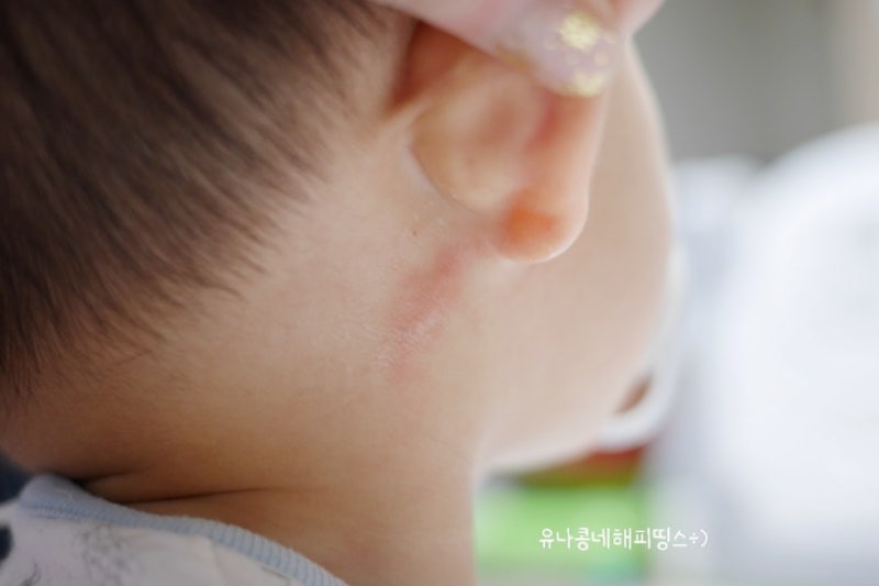 멀티밤으로 건조한 아기피부에 보습해줌 몽디에스 아토밤 네이버 블로그