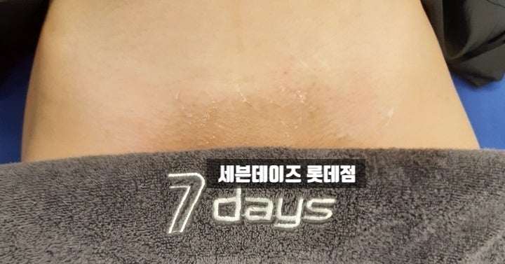 대전왁싱 여자브라질리언왁싱 시술 전후 꾸준한 관리가 중요해요 세븐데이즈 롯데점 네이버 블로그
