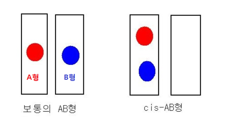 세계적으로 희귀한 혈액형 "CIS-AB"형... 지구촌 혈액형 : 네이버 블로그