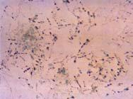 진단 미생물학 : 네이버 블로그