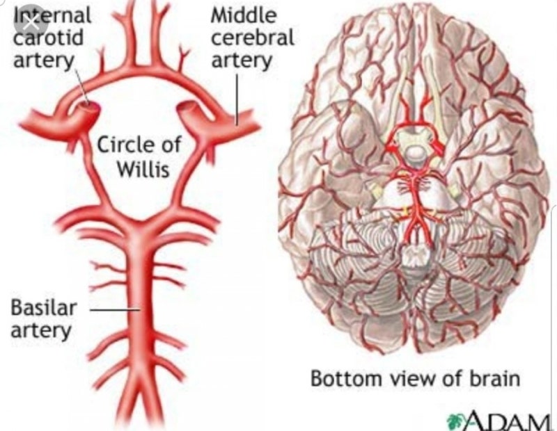 뇌동맥류(cerebral aneurysm) : 네이버 블로그