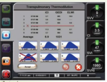 EV1000- Flotrac, volumeveiw, Presep setting방법 : 네이버 블로그