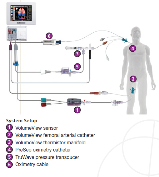EV1000- Flotrac, volumeveiw, Presep setting방법 : 네이버 블로그