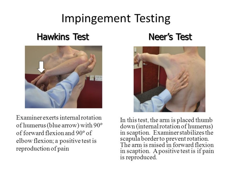 [성신여대한의원]충돌증후군(Impingement syndrome) : 네이버 블로그