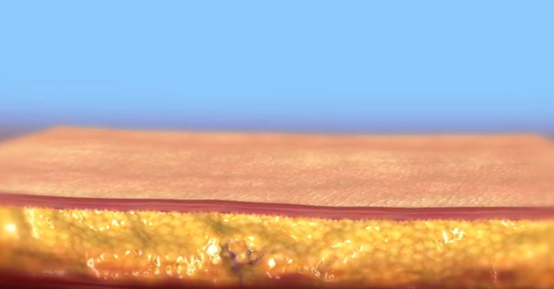 인모드 (INMODE), Mini fx, Forma - 반포 피부과, 방배 피부과 : 네이버 블로그