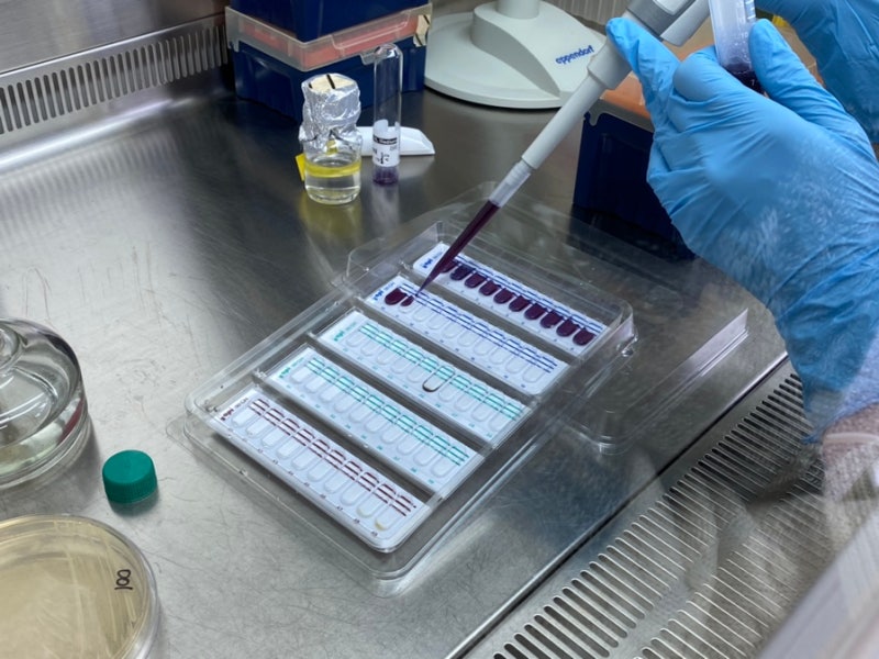 API 50CH, 50 CHL Medium : 네이버 블로그