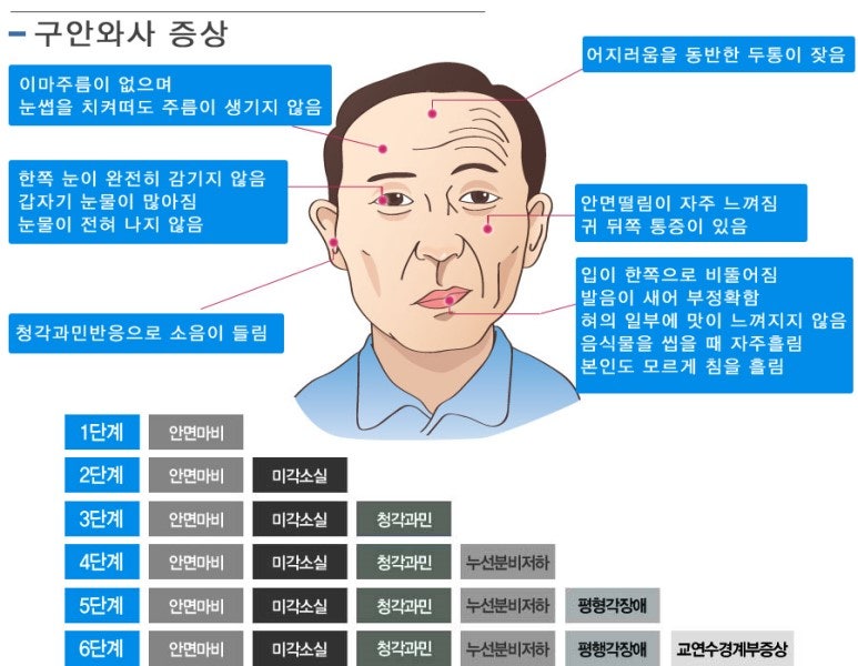 구안와사 초진 상담 후27일간 변화 2020 2 19 벨마비 안면신경마비 와사풍 람세이헌트 증후군 By 닥터요셉 채기헌