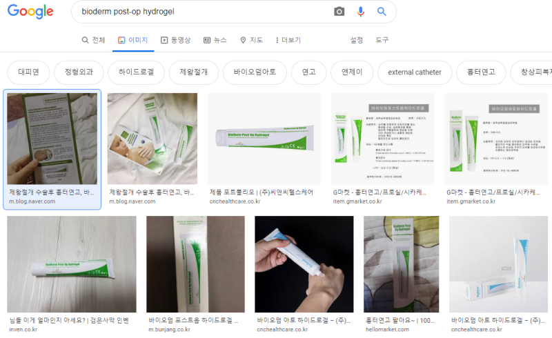 낙상사고 성형외과 봉합수술 흉터치료연고 실비보험금 청구feat 난 흉터연고 니 보험은실비보험 보험 안 될 가능성 매우