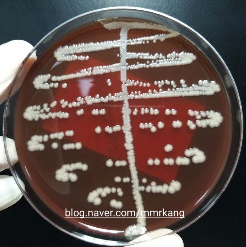 Candida tropicalis(캔디다 트로피칼리스) : 네이버 블로그