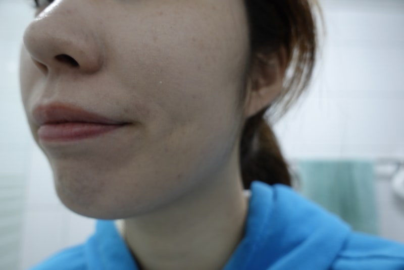 닥터지 약산성 클렌징 젤 폼 사용 후기 저자극클렌징 추천 네이버 블로그