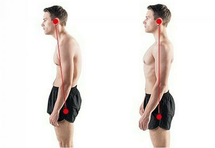 소흉근pectoralis Minor소흉근해부학굽은등 라운드숄더 손저림 어깨통증 팔드는게 힘들때 네이버 블로그