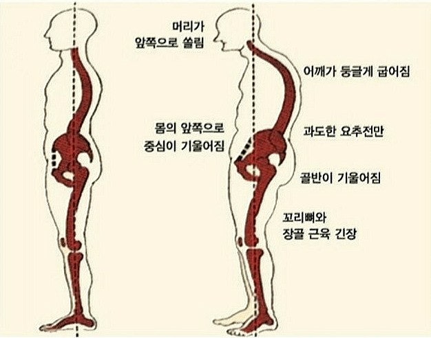 소흉근pectoralis Minor소흉근해부학굽은등 라운드숄더 손저림 어깨통증 팔드는게 힘들때 네이버 블로그