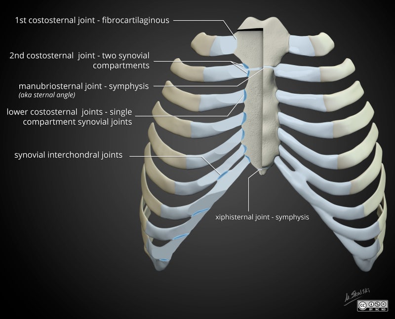 가슴이 아파요-티체 증후군(Tietze syndrone), 늑연골염, 흉곽통증 증후군 증상과 치료 : 네이버 블로그
