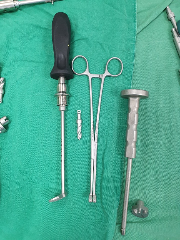 RTSA (exactech equinoxe) Dr.N : 네이버 블로그